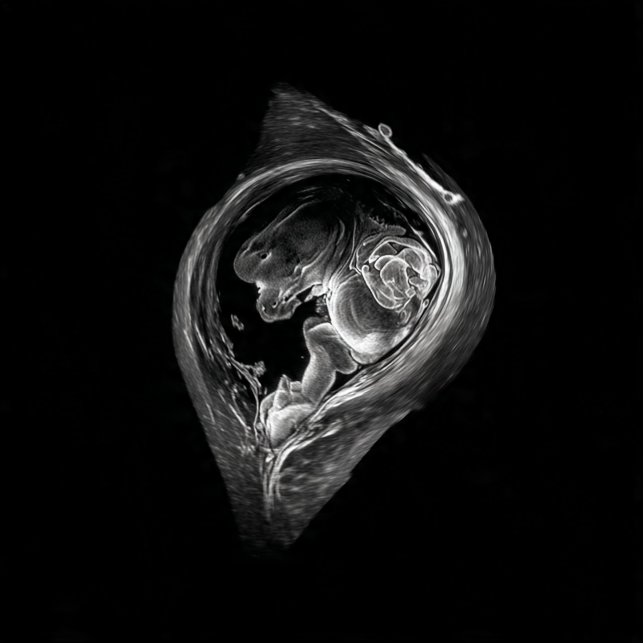 Types of Fetal Presentations During Pregnancy